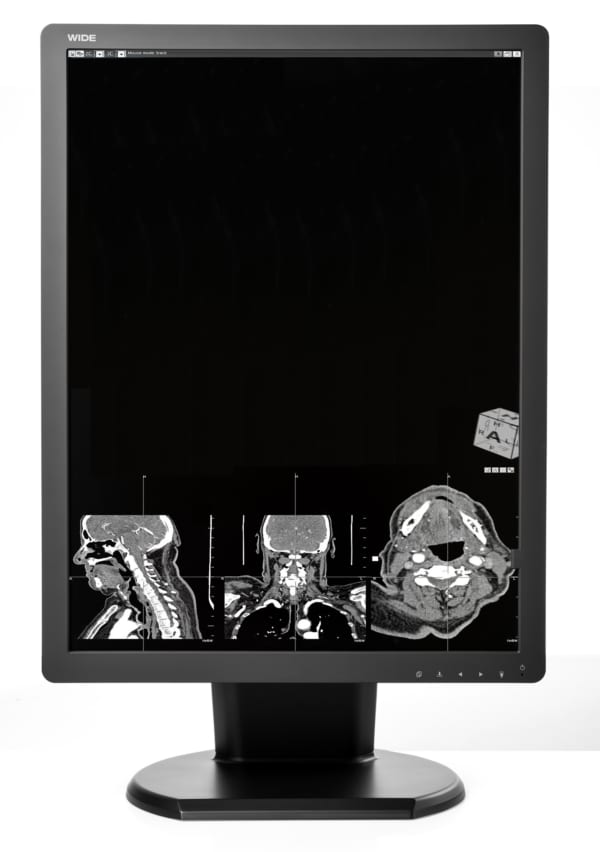 Màn hình y tế chẩn đoán 3MP CX30N - Đáp ứng chuẩn DICOM